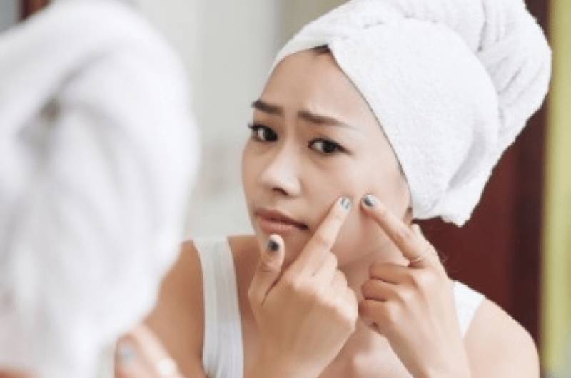 Acne Treatment | Acne Doctor Singapore | Aeon Medical and Aesthetic Centre